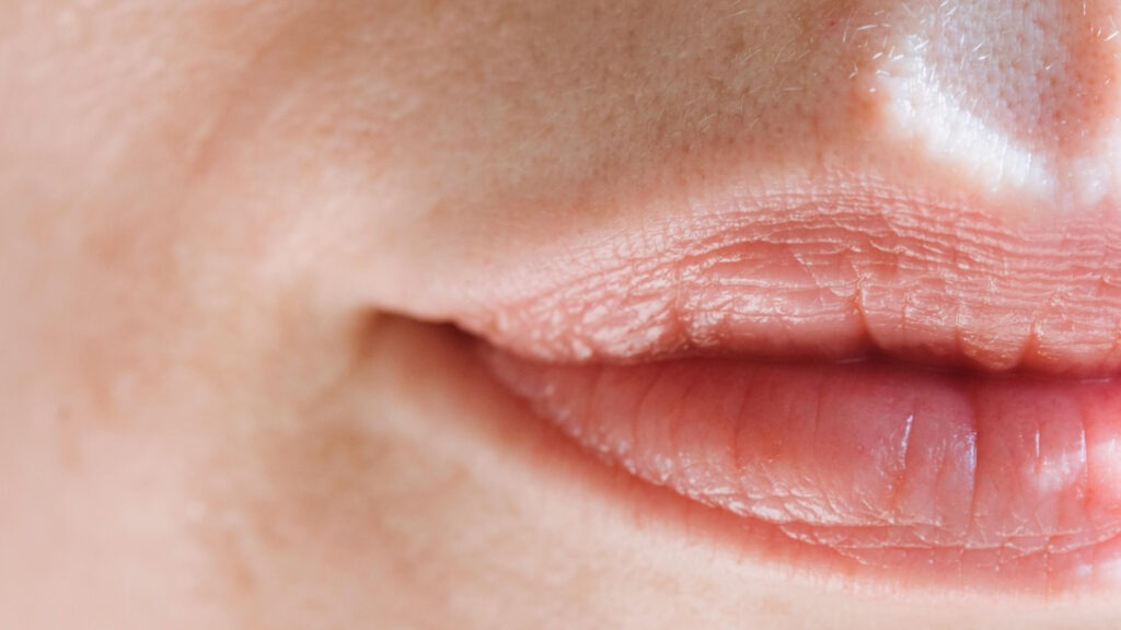 13 alimente care îți ajută corpul să producă mai mult colagen ...